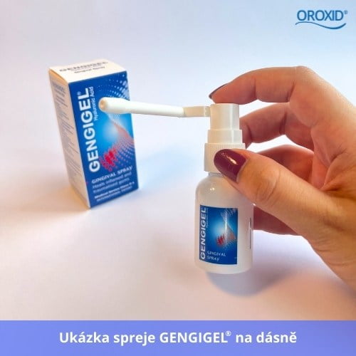GENGIGEL Sprej na dásně 20 ml | OROXID.CZ